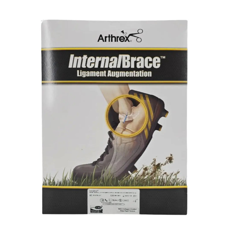 Arthrex AR-1788J-CP InternalBrace Implant System, Ligament – Primis Medical